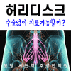 허리디스크 터지면 수술없이 치료가능할까 네이버 블로그